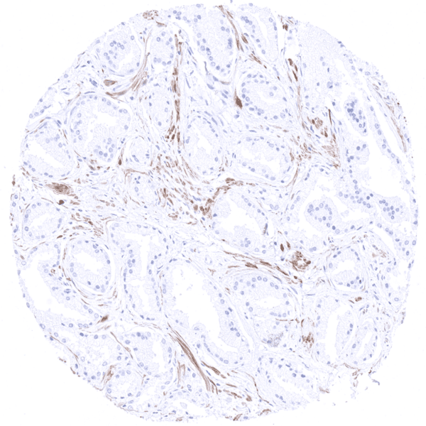 Cancer Tissue Gallery Calponin 1 - MS Validated Antibodies
