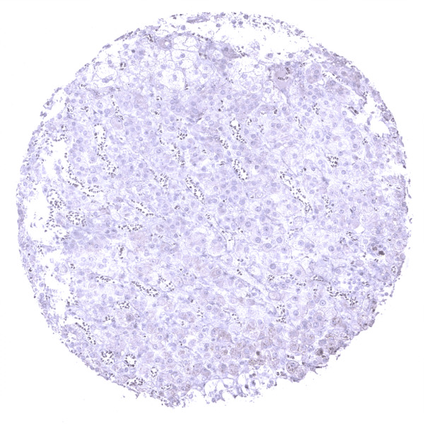 Normal Tissue Gallery Mesothelin - MS Validated Antibodies