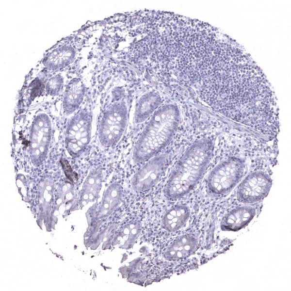 Normal Tissue Gallery Mesothelin - MS Validated Antibodies