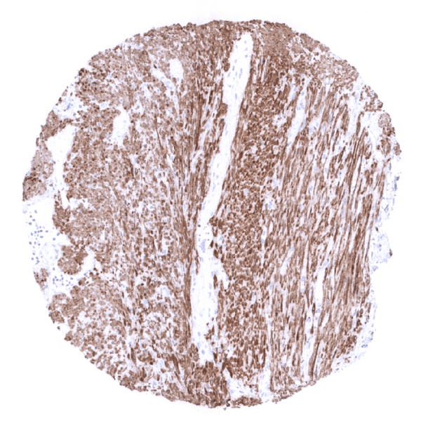 Normal Tissue Gallery Calponin 1 - MS Validated Antibodies