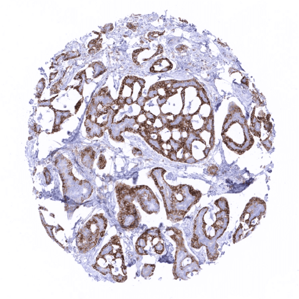 Cancer Tissue Gallery Mesothelin - MS Validated Antibodies