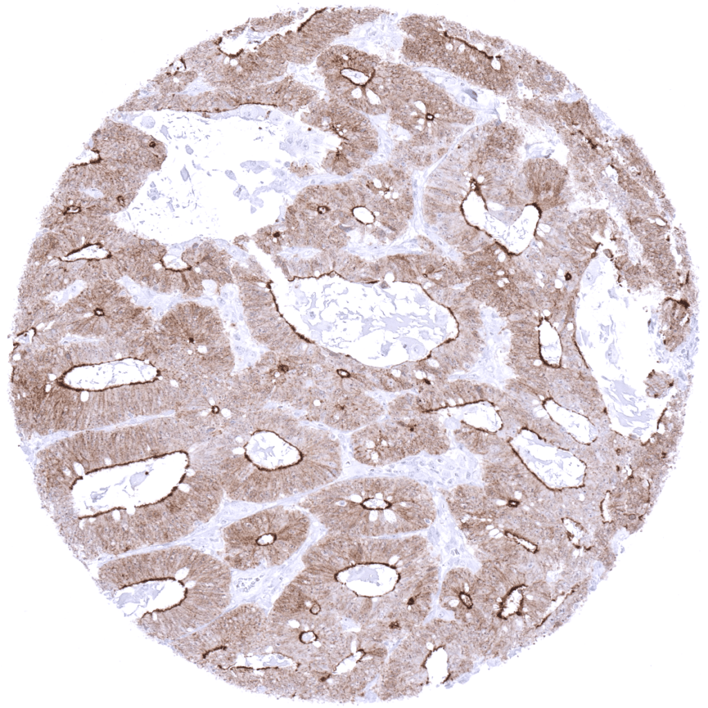 Villin (MSVA-459R) - MS Validated Antibodies
