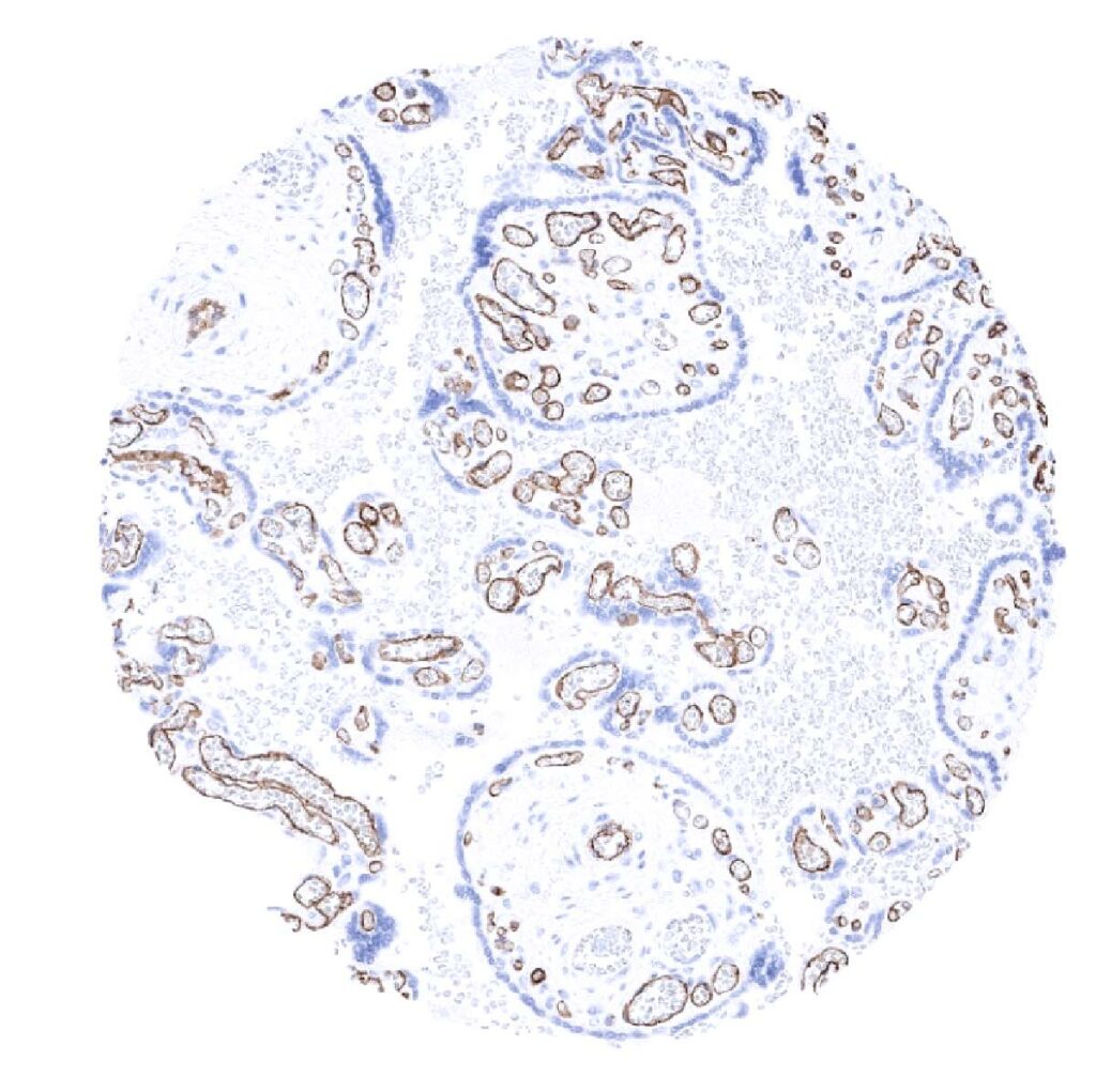 CD20 (MSVA-020R) - MS Validated Antibodies