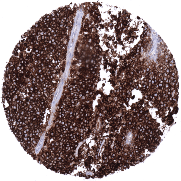 Cancer Tissue Gallery PLAP - MS Validated Antibodies