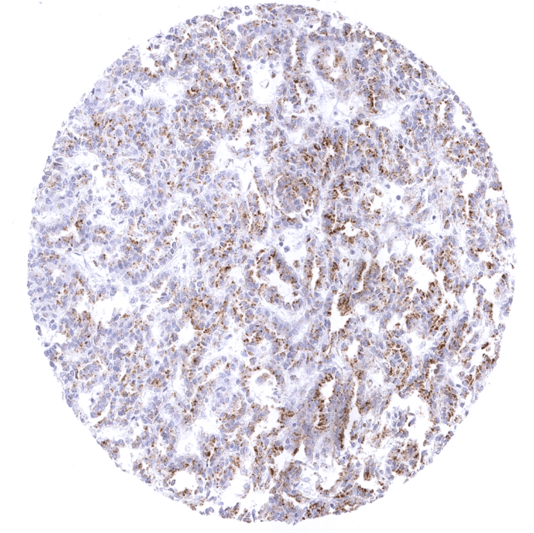 Cancer Tissue Gallery Napsin A - MS Validated Antibodies