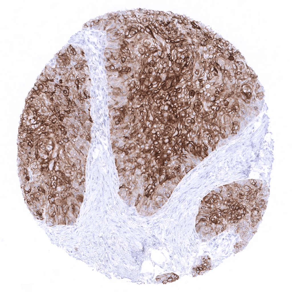 Mesothelin (MSVA-235M) - MS Validated Antibodies