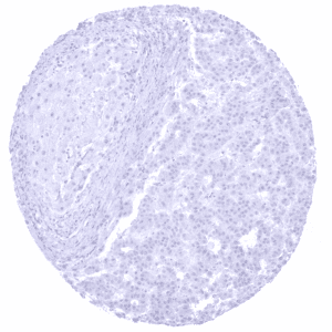 Cancer Tissue Gallery Napsin A - MS Validated Antibodies