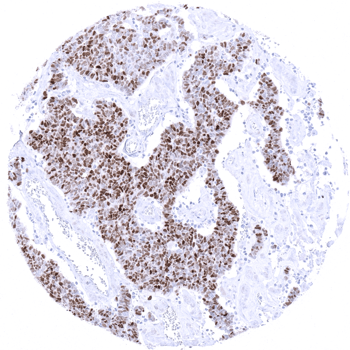 TdT (MSVA-453R) - MS Validated Antibodies