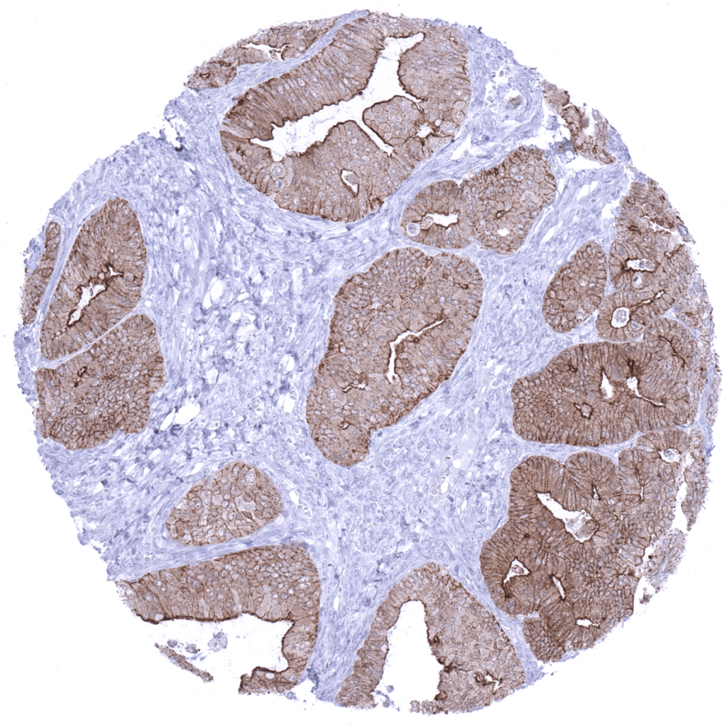 Villin (MSVA-459R) - MS Validated Antibodies