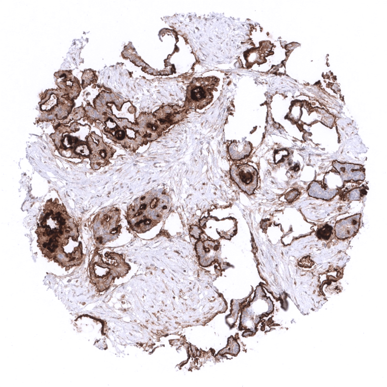 Cancer Tissue Gallery Mesothelin - MS Validated Antibodies