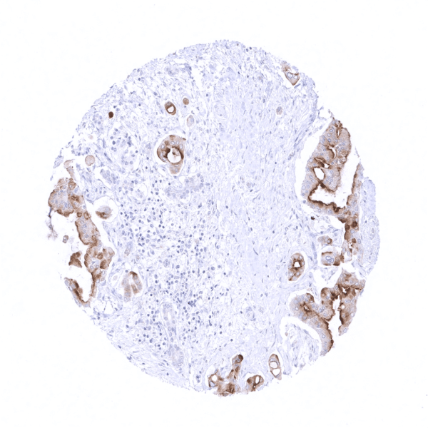 Cancer Tissue Gallery Mesothelin - MS Validated Antibodies