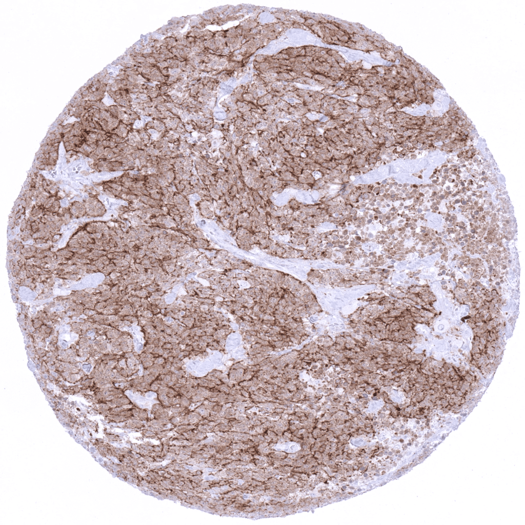 Villin (MSVA-459R) - MS Validated Antibodies