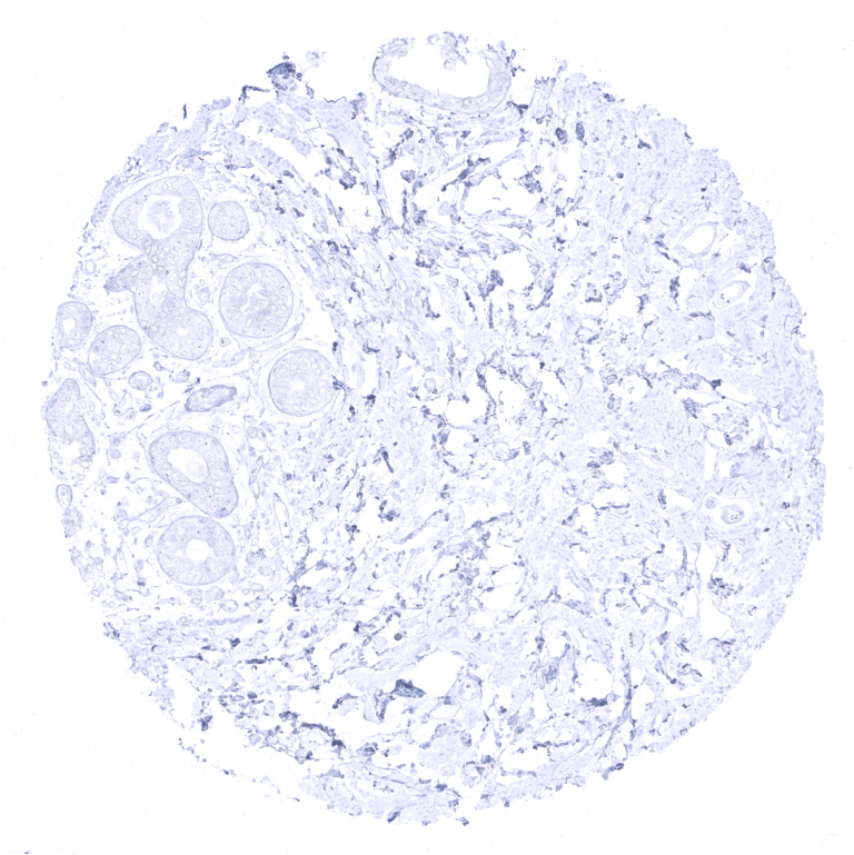 Normal Tissue Gallery TdT - MS Validated Antibodies