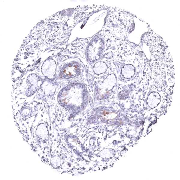 Normal Tissue Gallery Mesothelin - MS Validated Antibodies