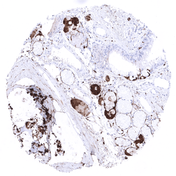 Normal Tissue Gallery S100B - MS Validated Antibodies