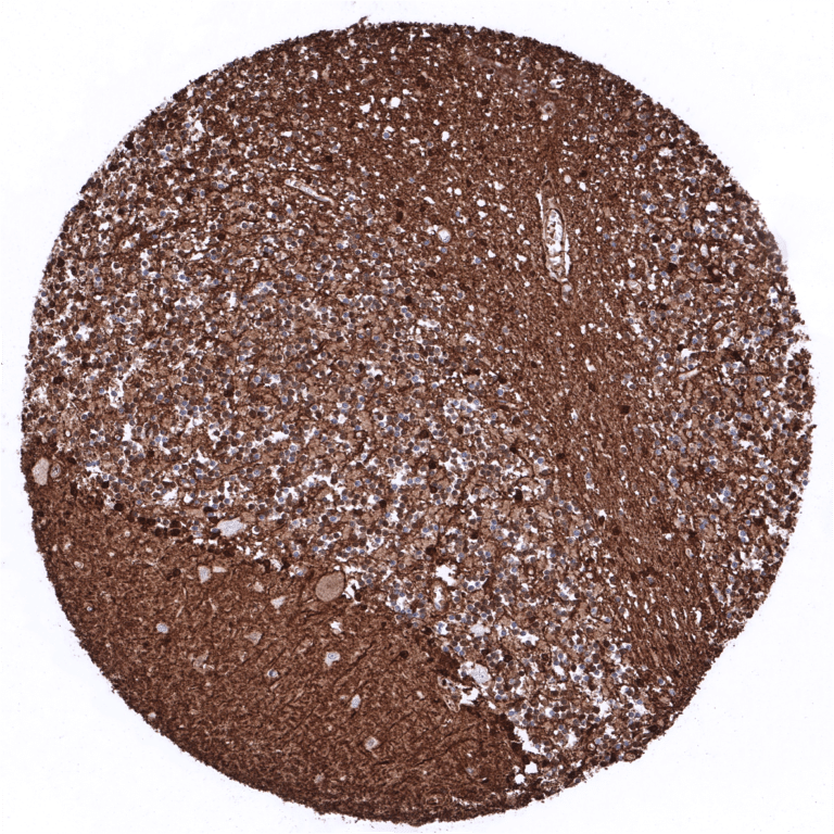 Normal Tissue Gallery S100B - MS Validated Antibodies