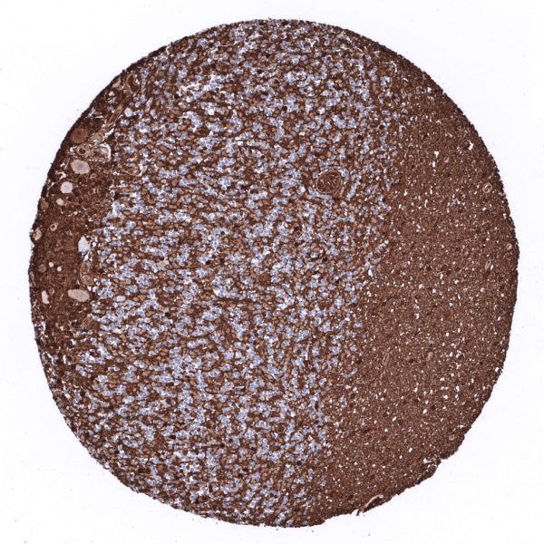 Normal Tissue Gallery S100B - MS Validated Antibodies