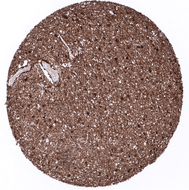 Normal Tissue Gallery S100B - MS Validated Antibodies