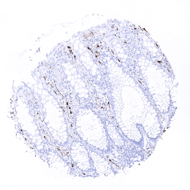 Normal Tissue Gallery S100B - MS Validated Antibodies