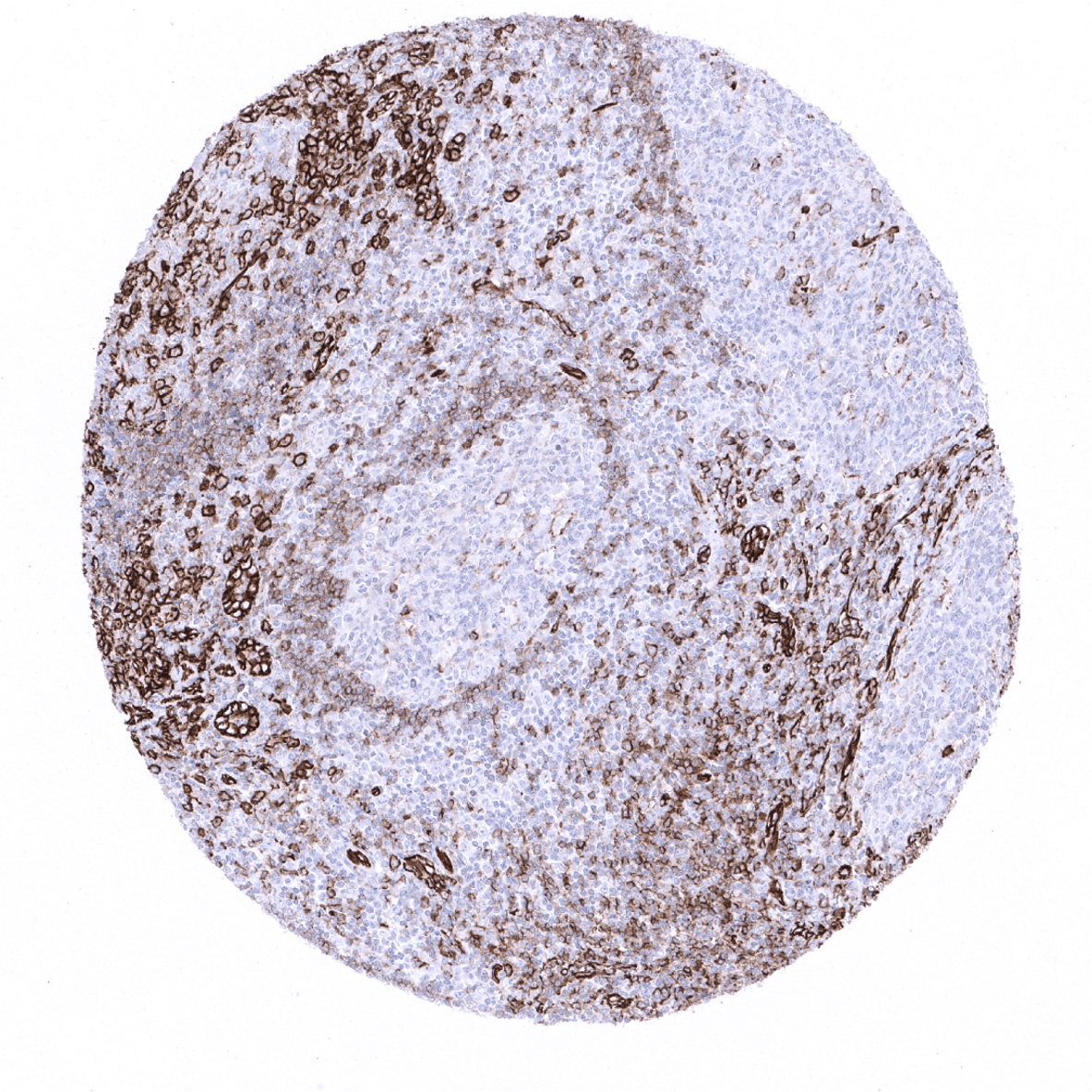 CD31 (MSVA-031M) - MS Validated Antibodies