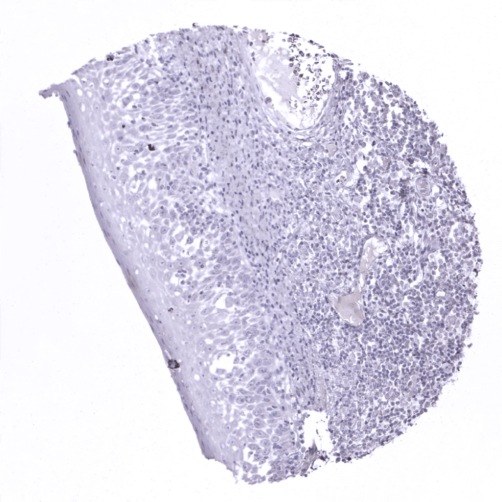 Mesothelin (MSVA-235M) - MS Validated Antibodies