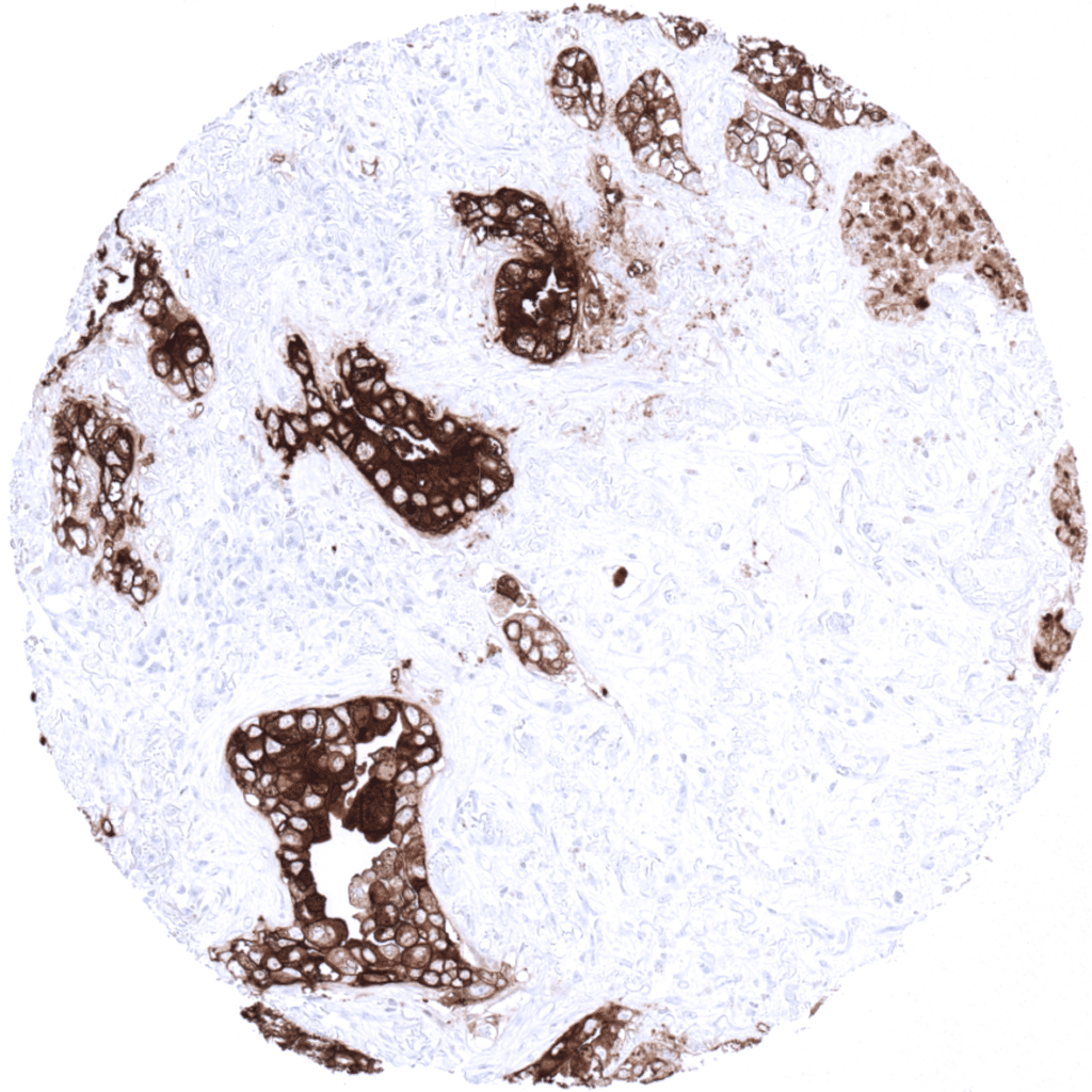 CEA / CD66e / CEACAM5 (MSVA-465R) - MS Validated Antibodies