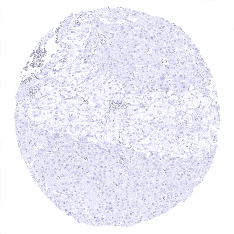 Normal Tissue Gallery CEA - MS Validated Antibodies