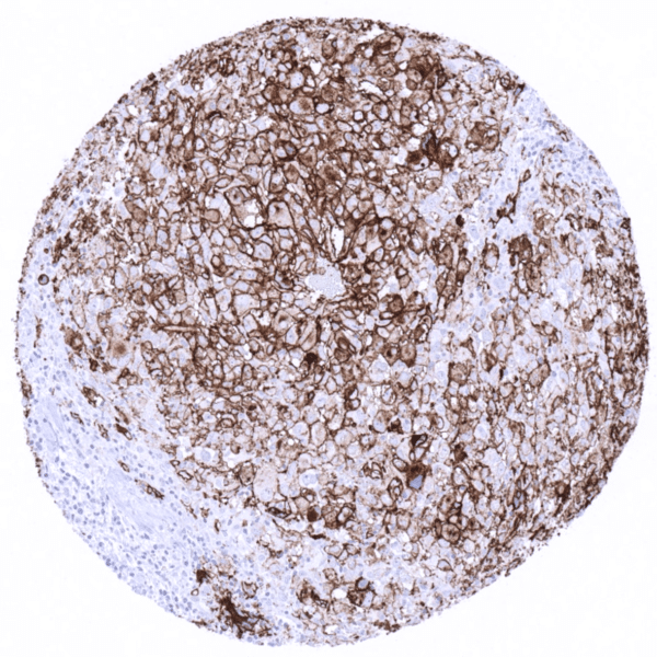 Cancer Tissue Gallery CD34 - MS Validated Antibodies