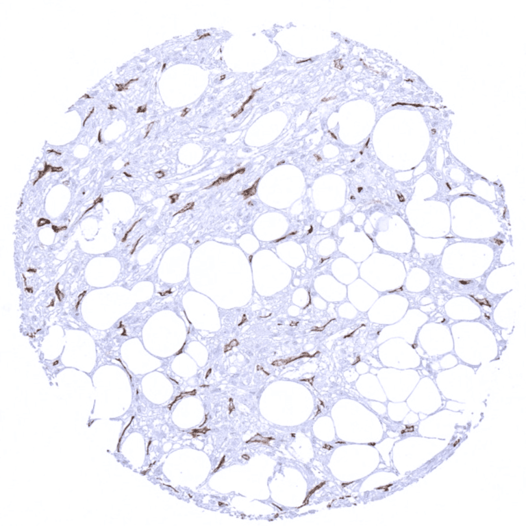 Cancer Tissue Gallery CD34 - MS Validated Antibodies