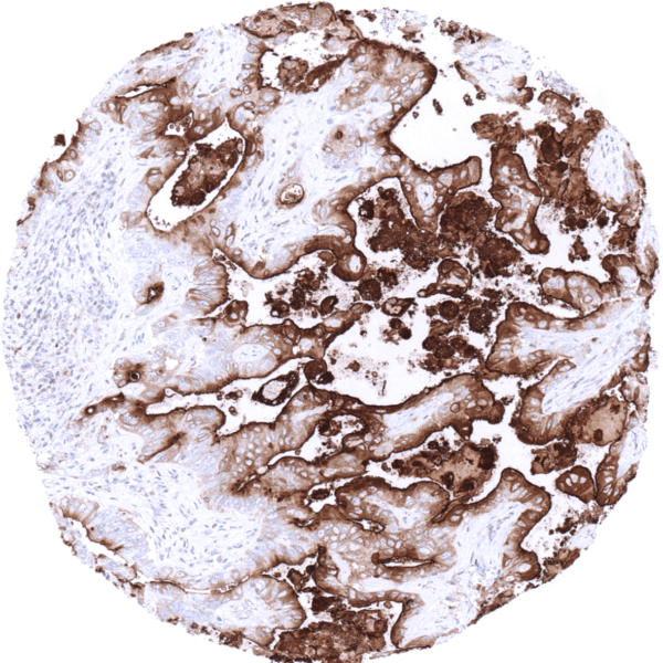 Cancer Tissue Gallery CEA - MS Validated Antibodies