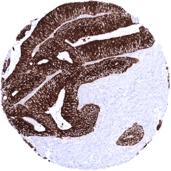 Cancer Tissue Gallery MUC6 - MS Validated Antibodies