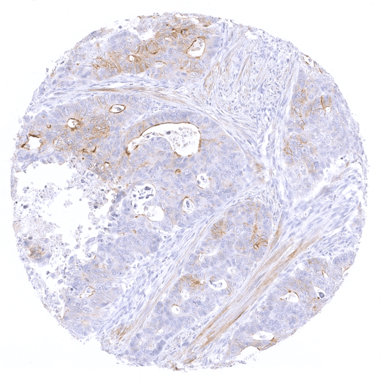 Cancer Tissue Gallery DOG-1 - MS Validated Antibodies