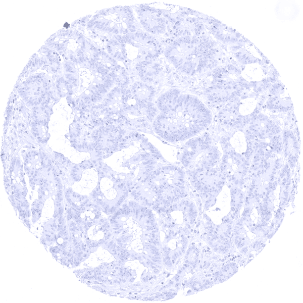 Cancer Tissue Gallery Cytokeratin 13 - MS Validated Antibodies