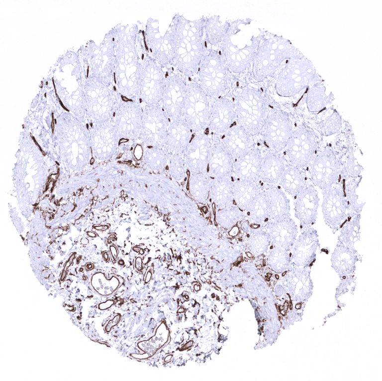 Normal Tissue Gallery CD34 - MS Validated Antibodies
