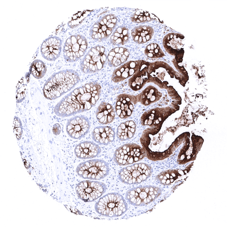 Normal Tissue Gallery CEA - MS Validated Antibodies