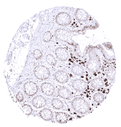 Normal Tissue Gallery INI1 - MS Validated Antibodies