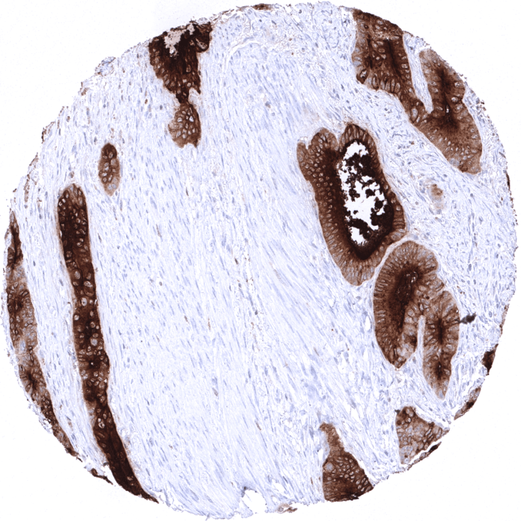 CEA / CD66e / CEACAM5 (MSVA-465R) - MS Validated Antibodies