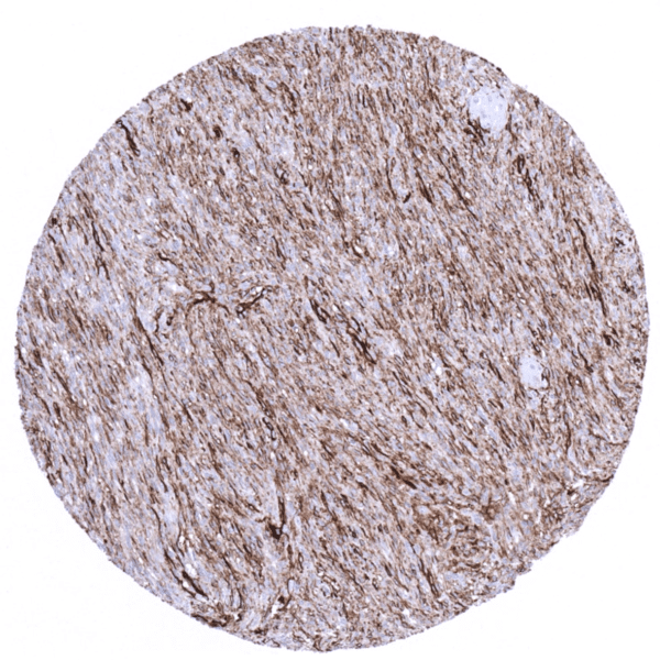 Cancer Tissue Gallery CD34 - MS Validated Antibodies