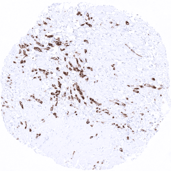 Cancer Tissue Gallery CEA - MS Validated Antibodies