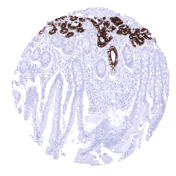 Normal Tissue Gallery MUC6 - MS Validated Antibodies