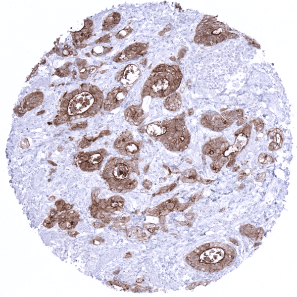 Cancer Tissue Gallery Villin - MS Validated Antibodies