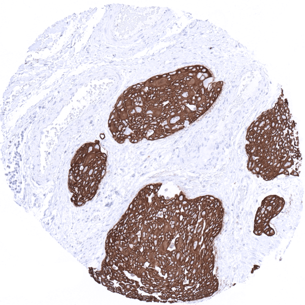 Cancer Tissue Gallery Cytokeratin 13 - MS Validated Antibodies