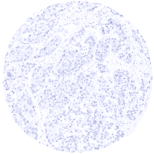 Cancer Tissue Gallery CEA - MS Validated Antibodies