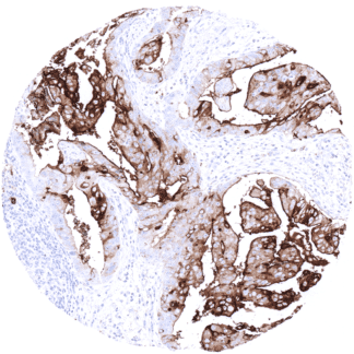Cancer Tissue Gallery CEA - MS Validated Antibodies