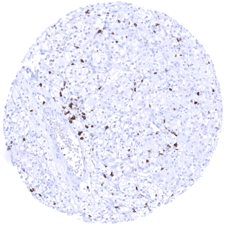 Cancer Tissue Gallery CD7 - MS Validated Antibodies