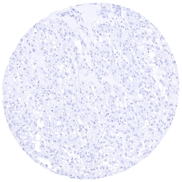 Cancer Tissue Gallery Cytokeratin 13 - MS Validated Antibodies