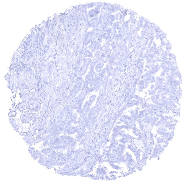 Cancer Tissue Gallery MUC6 - MS Validated Antibodies