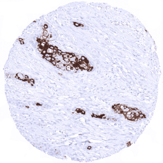 Cancer Tissue Gallery Cytokeratin 13 - MS Validated Antibodies