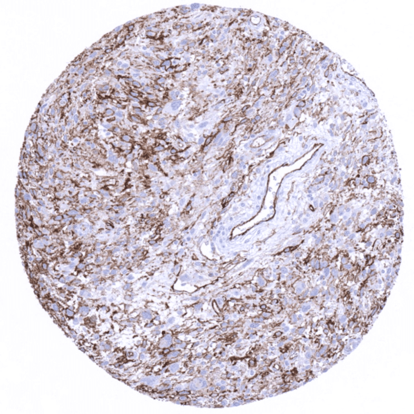 Cancer Tissue Gallery CD34 - MS Validated Antibodies