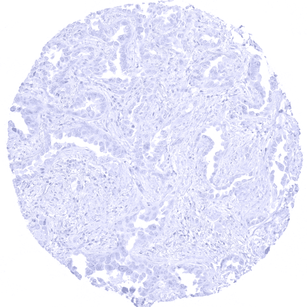 Cancer Tissue Gallery Cytokeratin 13 - MS Validated Antibodies
